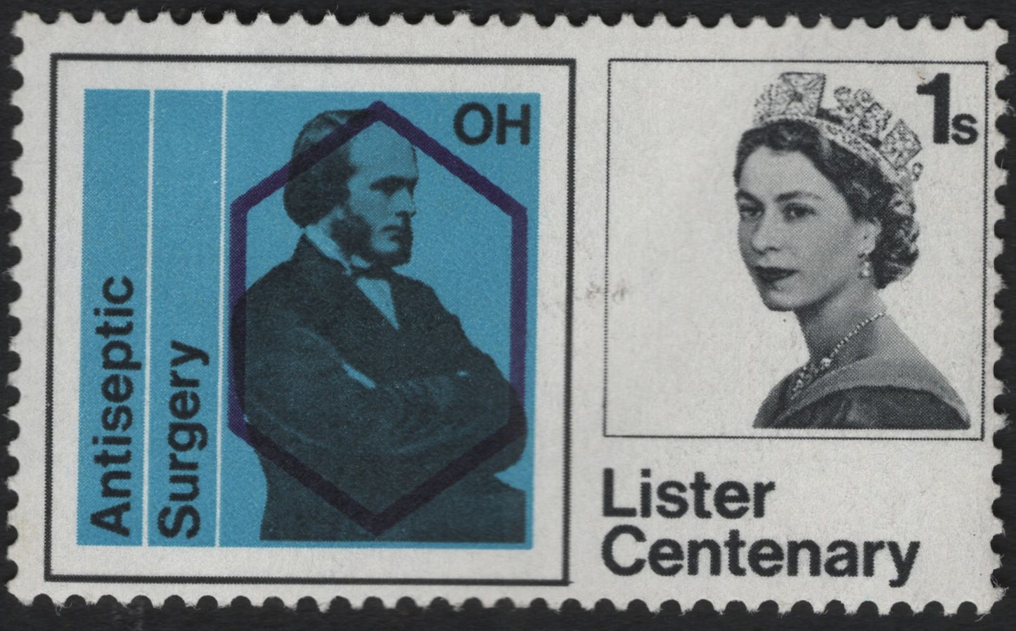 SCG9517 - United Kingdom 1965 Lister Centenary – Antiseptic Surgery (1 ...